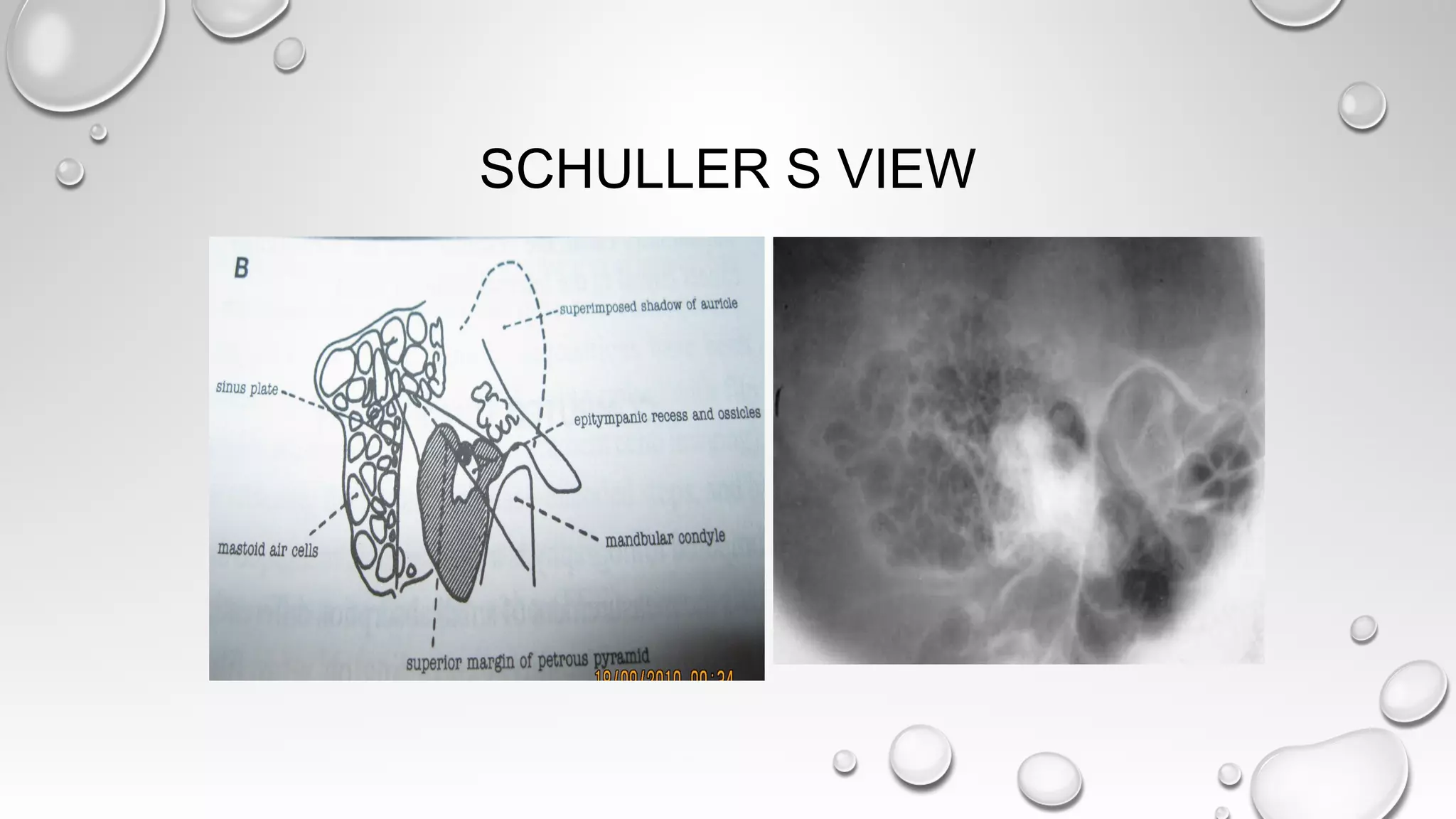 Radiological Imaging in Head and Neck and relevant anatomy | PPT