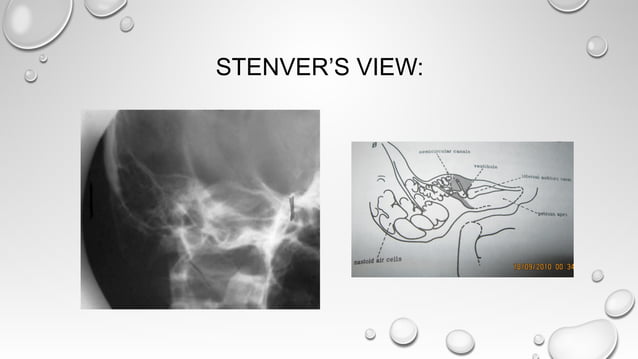 Radiological Imaging in Head and Neck and relevant anatomy | PPT | Ear ...