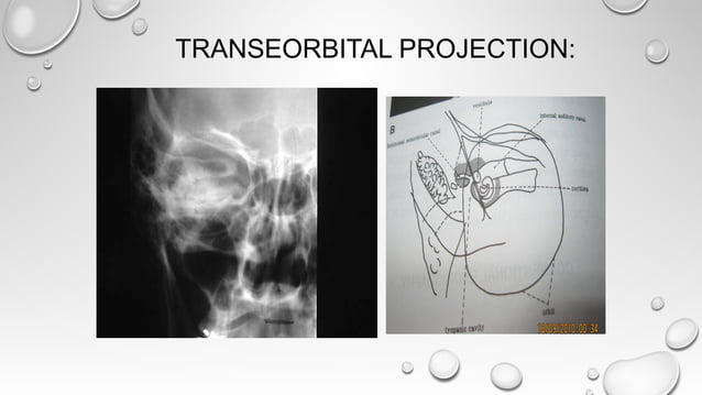 Radiological Imaging in Head and Neck and relevant anatomy | PPT | Ear ...