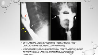 Radiological Imaging in Head and Neck and relevant anatomy | PPT