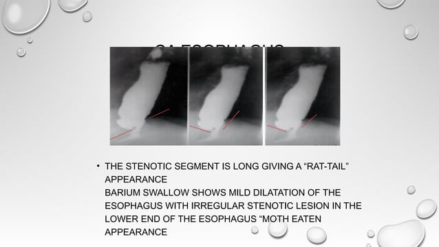 Radiological Imaging in Head and Neck and relevant anatomy | PPT | Ear ...