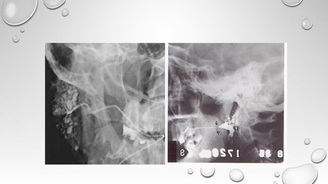 Radiological Imaging in Head and Neck and relevant anatomy | PPT | Ear ...