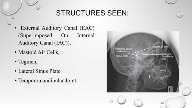 Radiological Imaging in Head and Neck and relevant anatomy | PPT | Ear ...