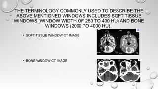 Radiological Imaging in Head and Neck and relevant anatomy | PPT