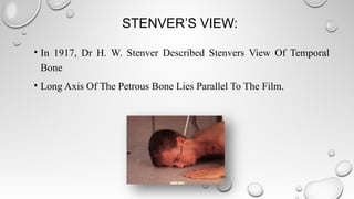 Radiological Imaging in Head and Neck and relevant anatomy | PPT