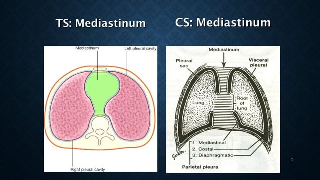 Radiology day 3 mediastinal anatomy | PPT