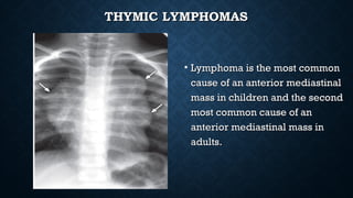 Radiology day 3 mediastinal anatomy | PPT