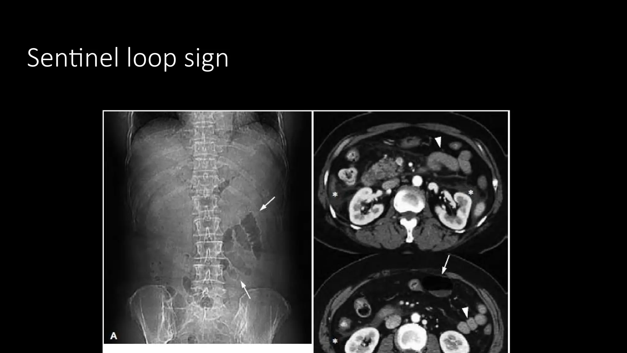 Radiology, ECG and ABG spotters for emergency medicine.pptx