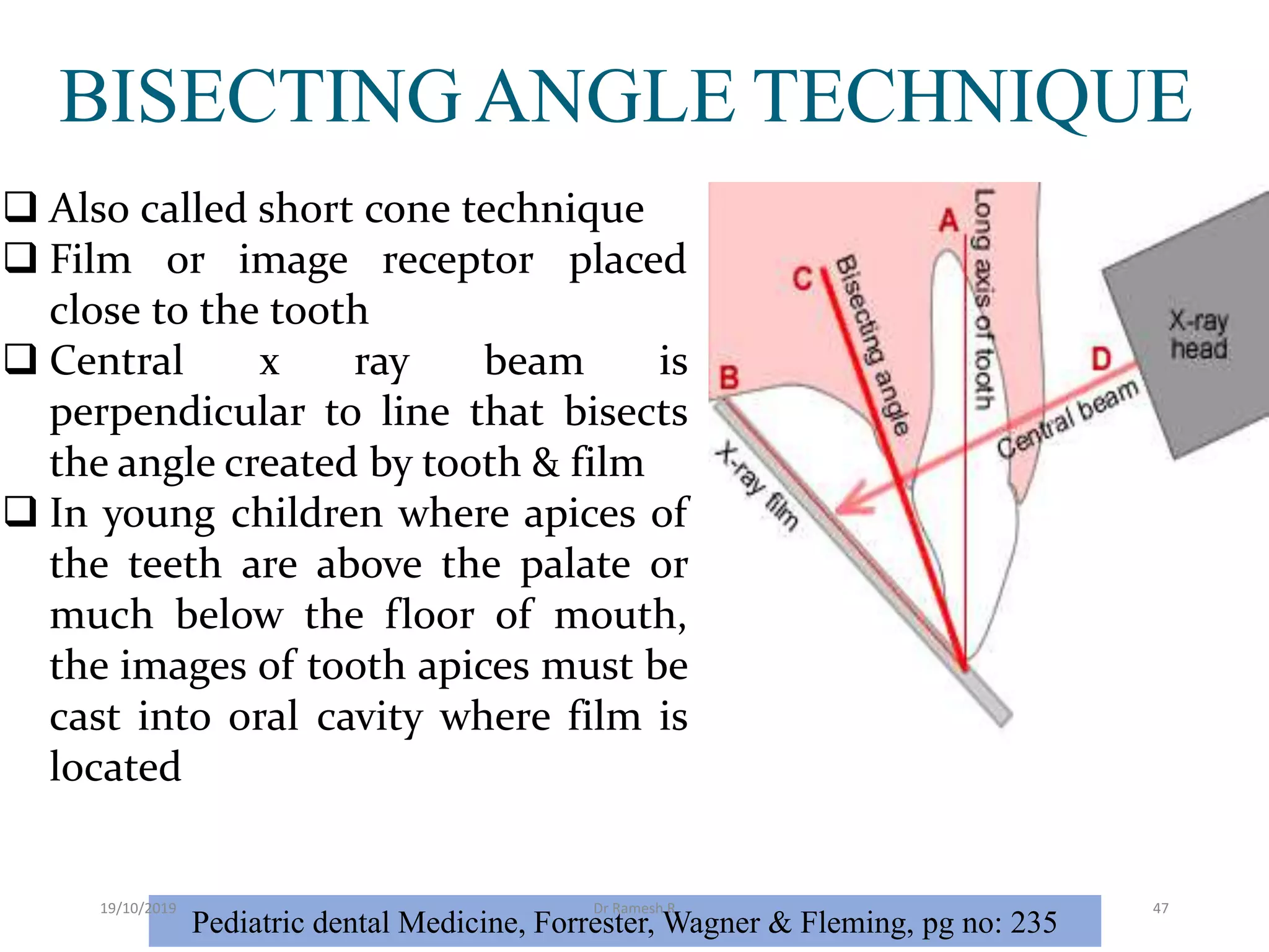 Radiograpgy in Pediatric Dentistry | PPT