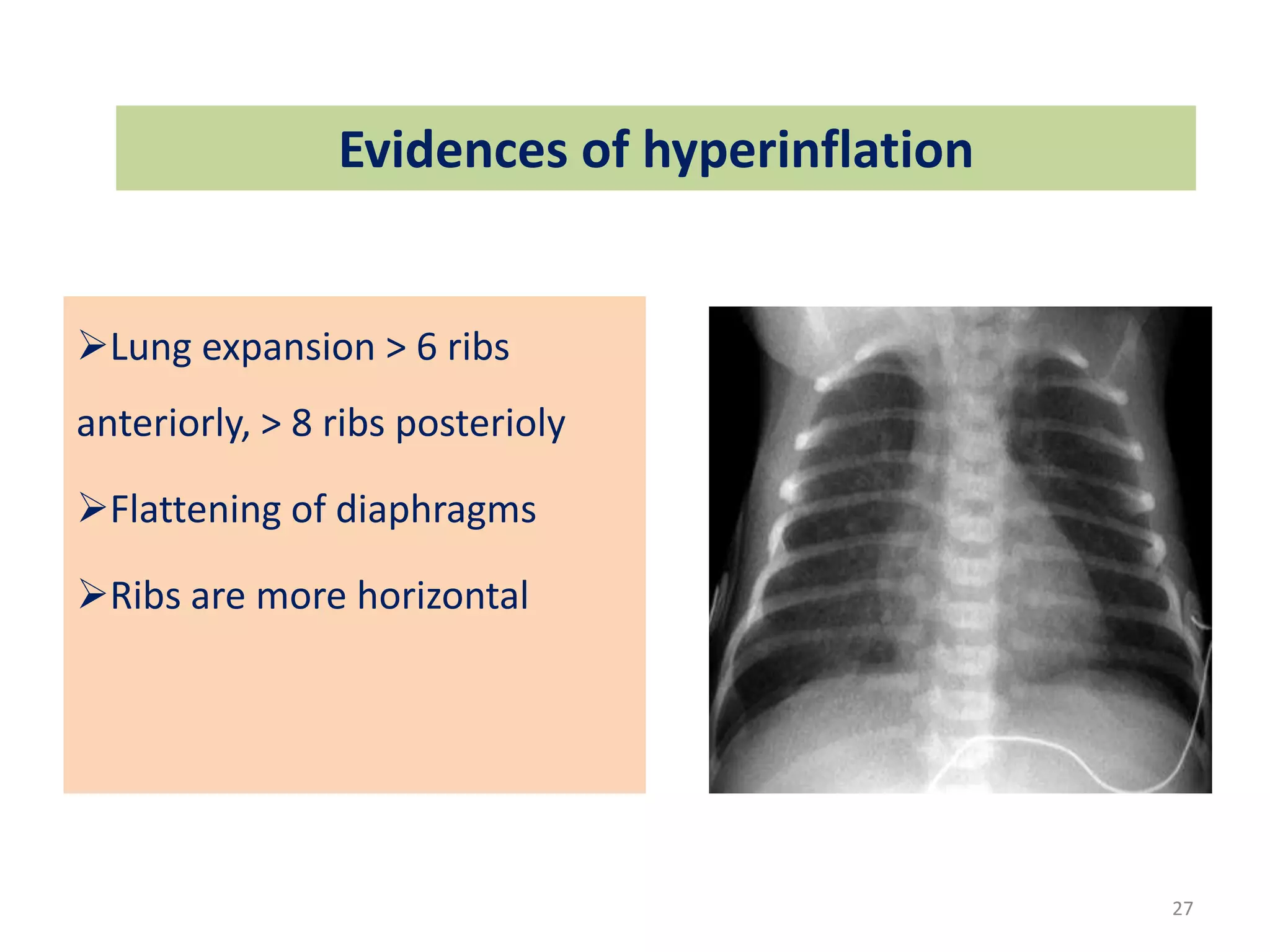 common neonatal Radiology findings | PPT