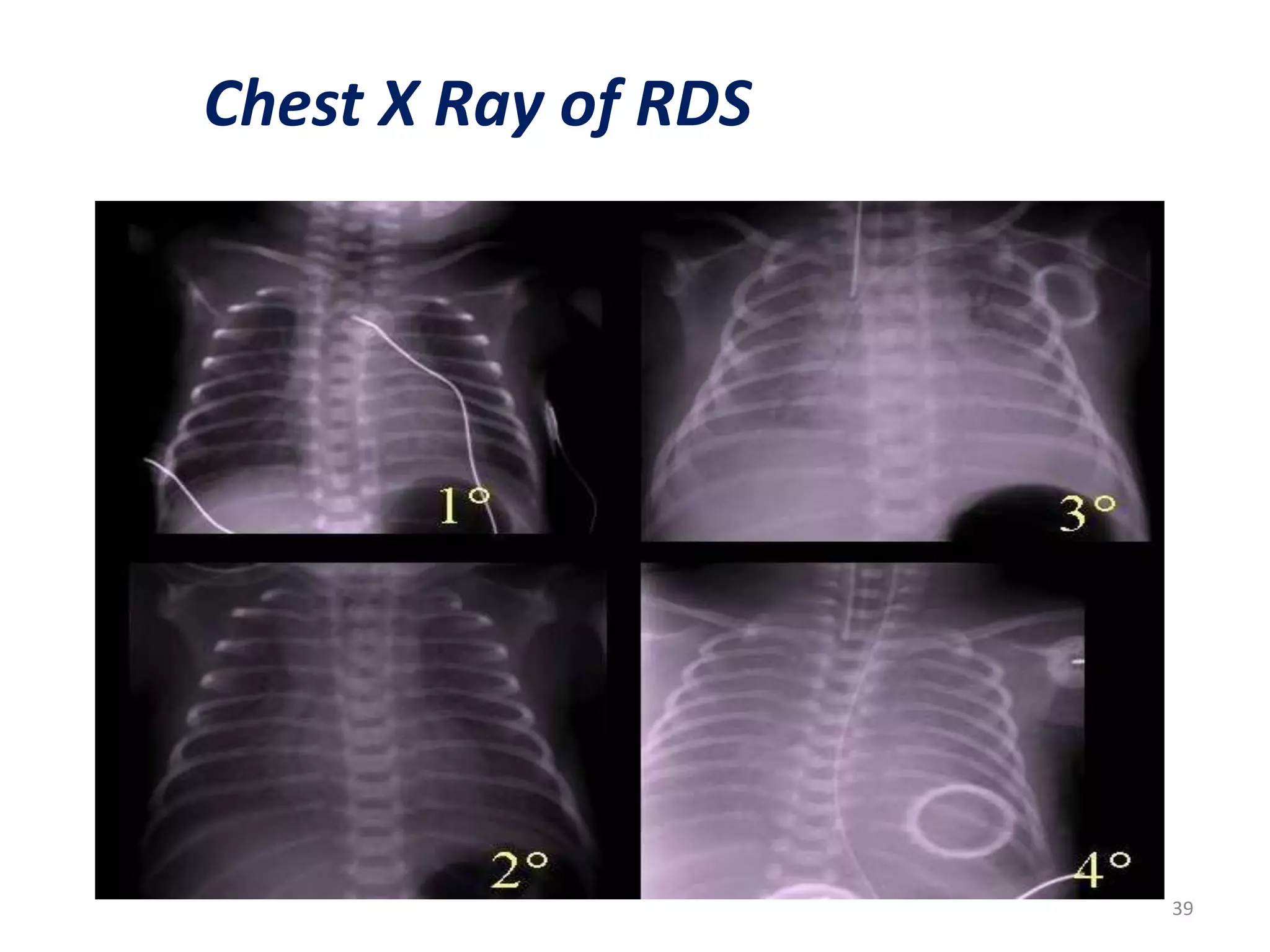 common neonatal Radiology findings | PPT
