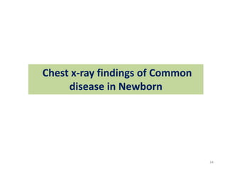 common neonatal Radiology findings | PPT