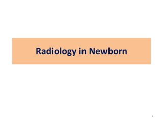 common neonatal Radiology findings | PPT