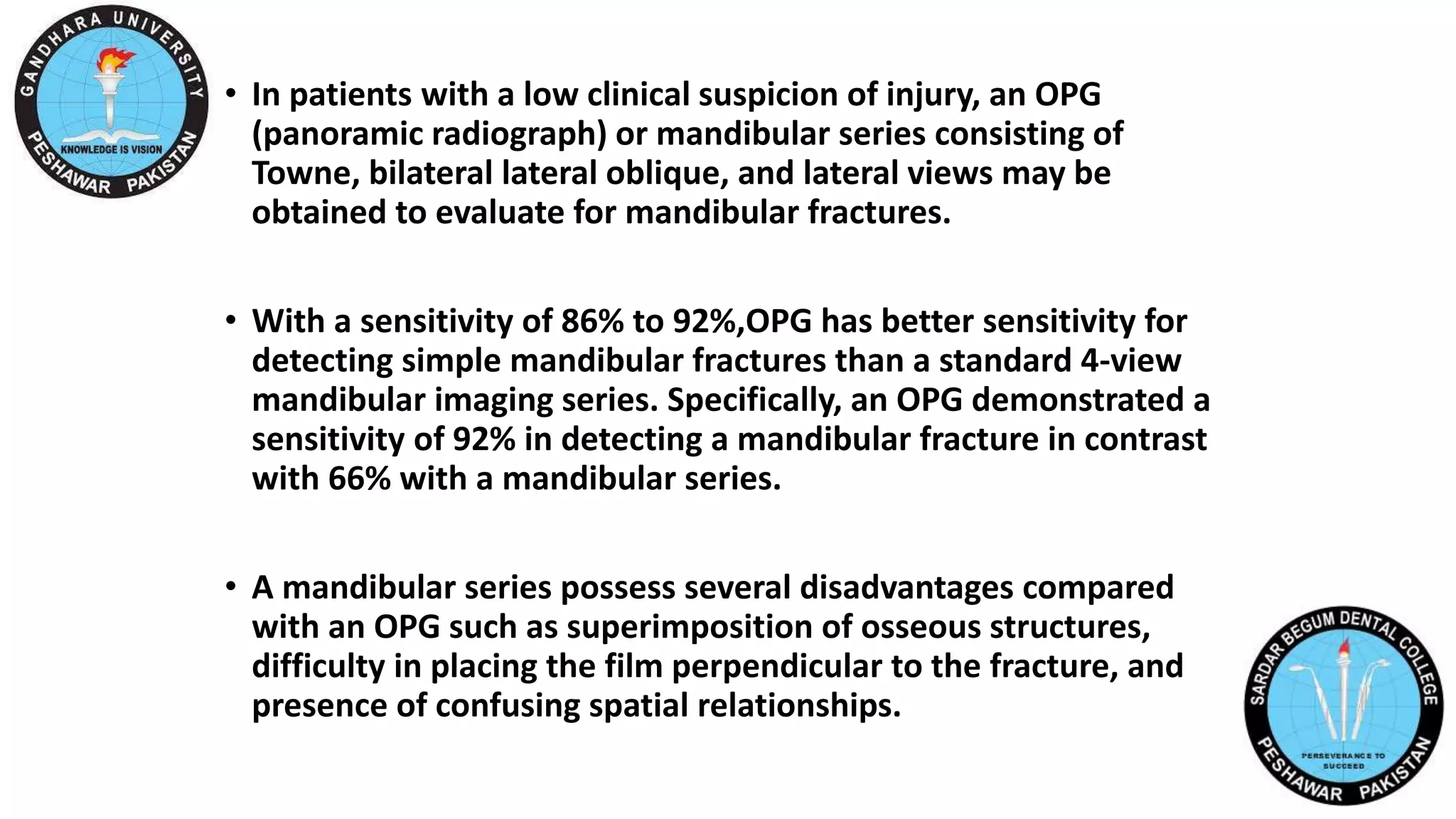 Radiology for Maxillofacial Trauma.pptx