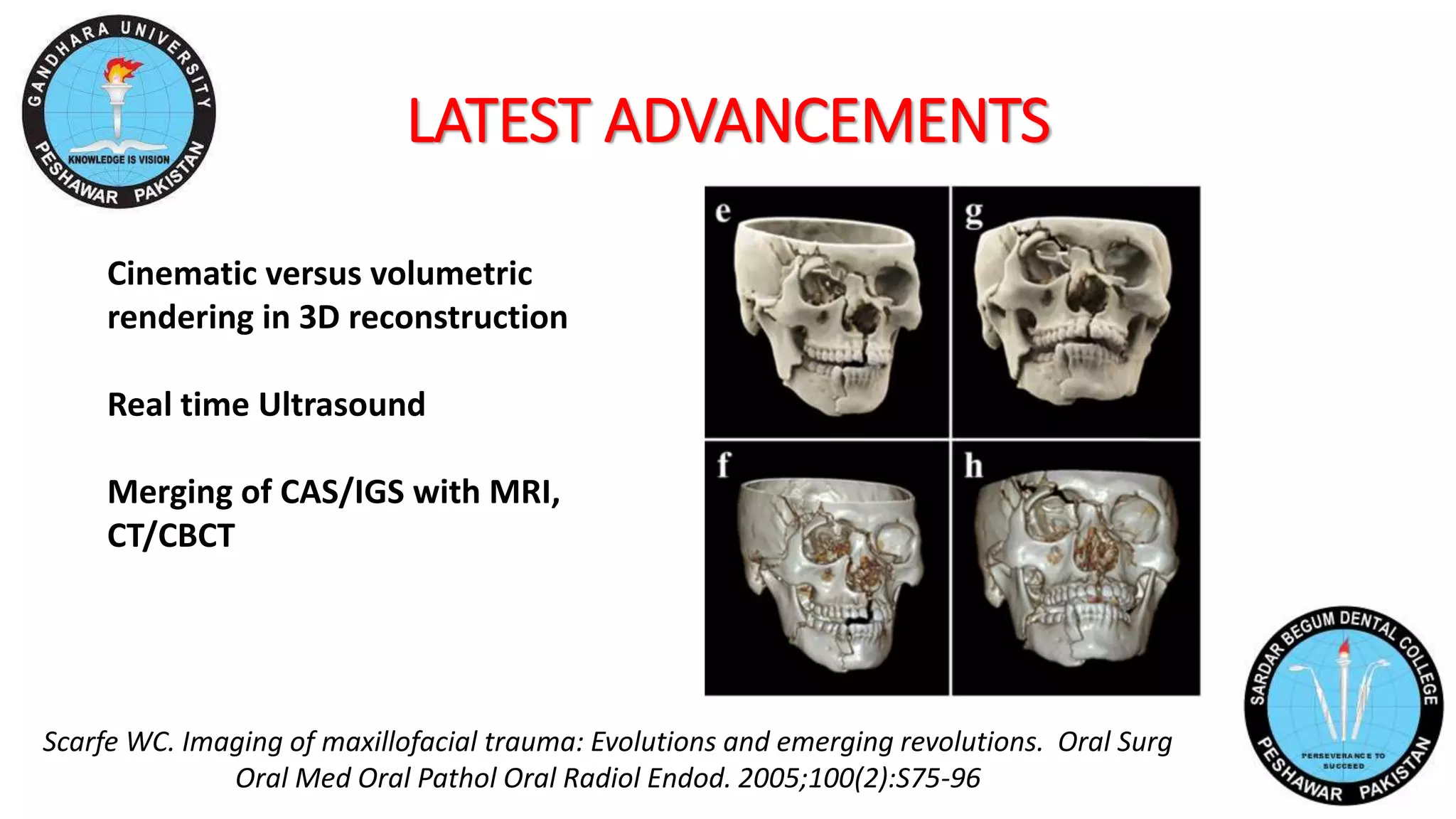 Radiology for Maxillofacial Trauma.pptx