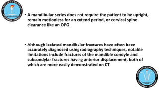 Radiology for Maxillofacial Trauma.pptx