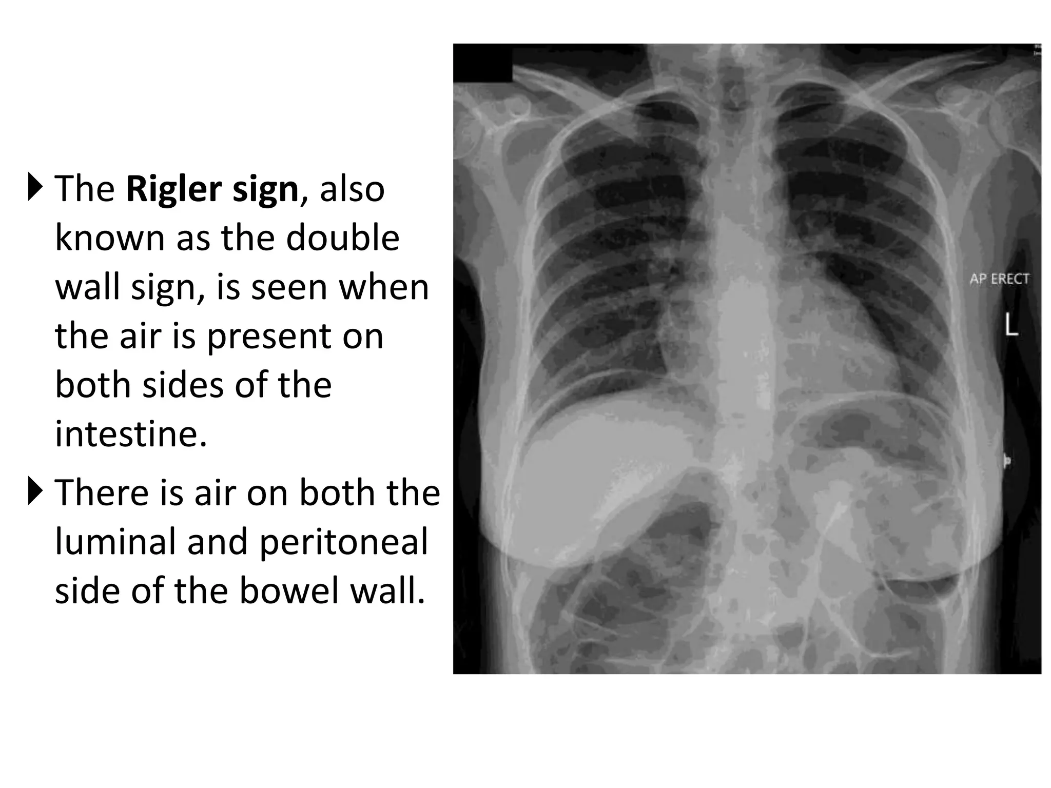Radiology GIT.ppt