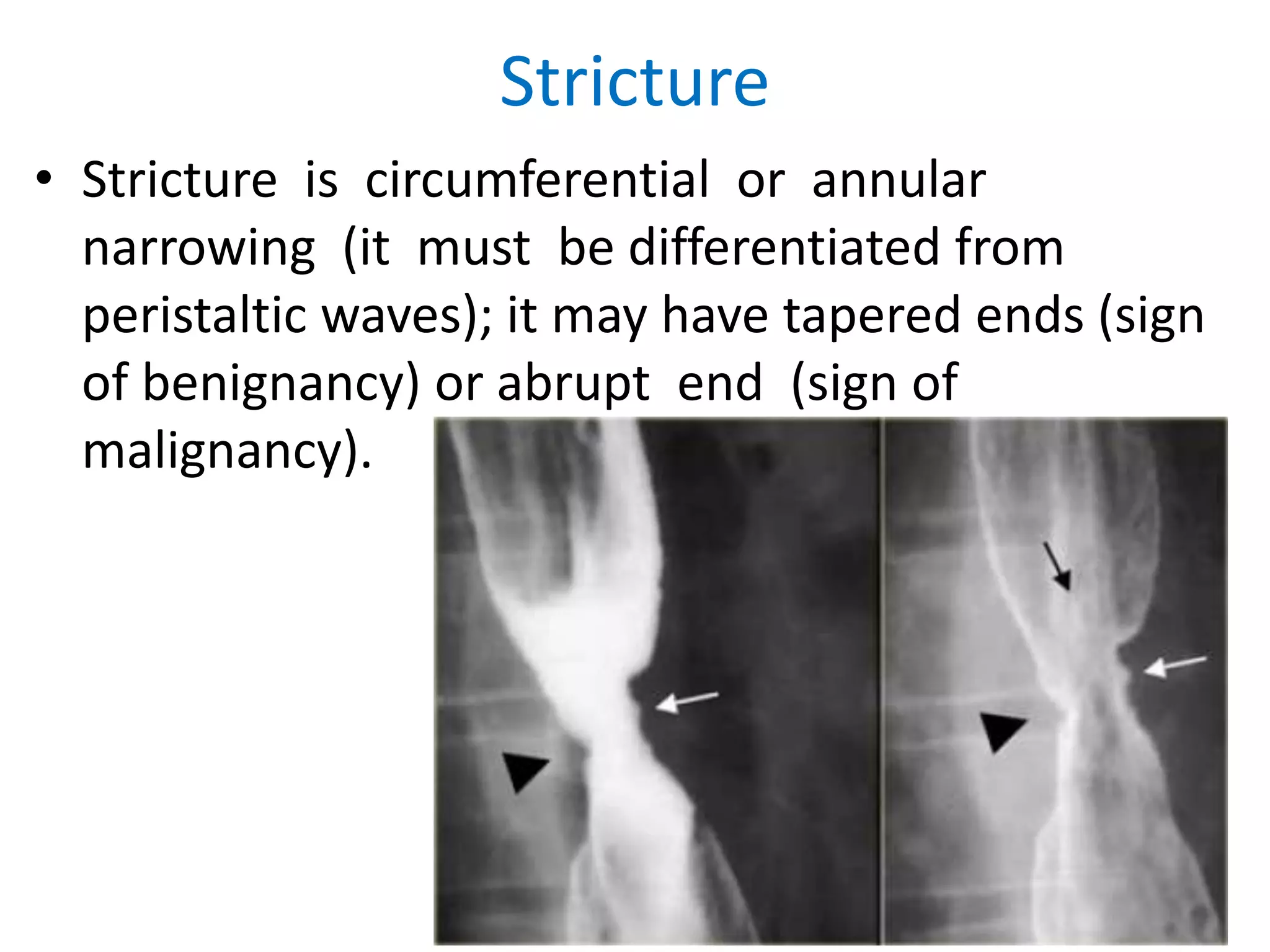 Radiology GIT.ppt