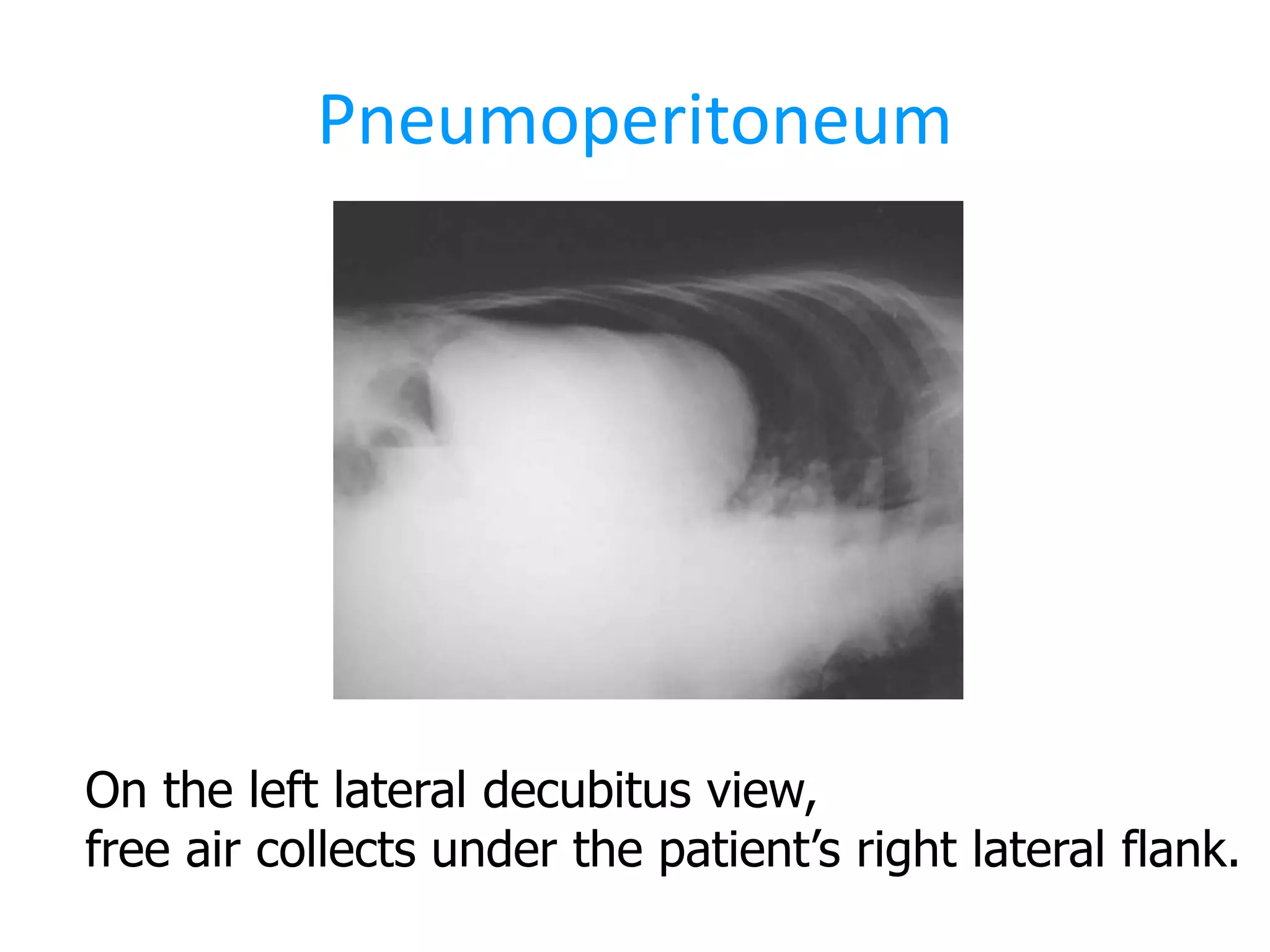 Radiology GIT.ppt