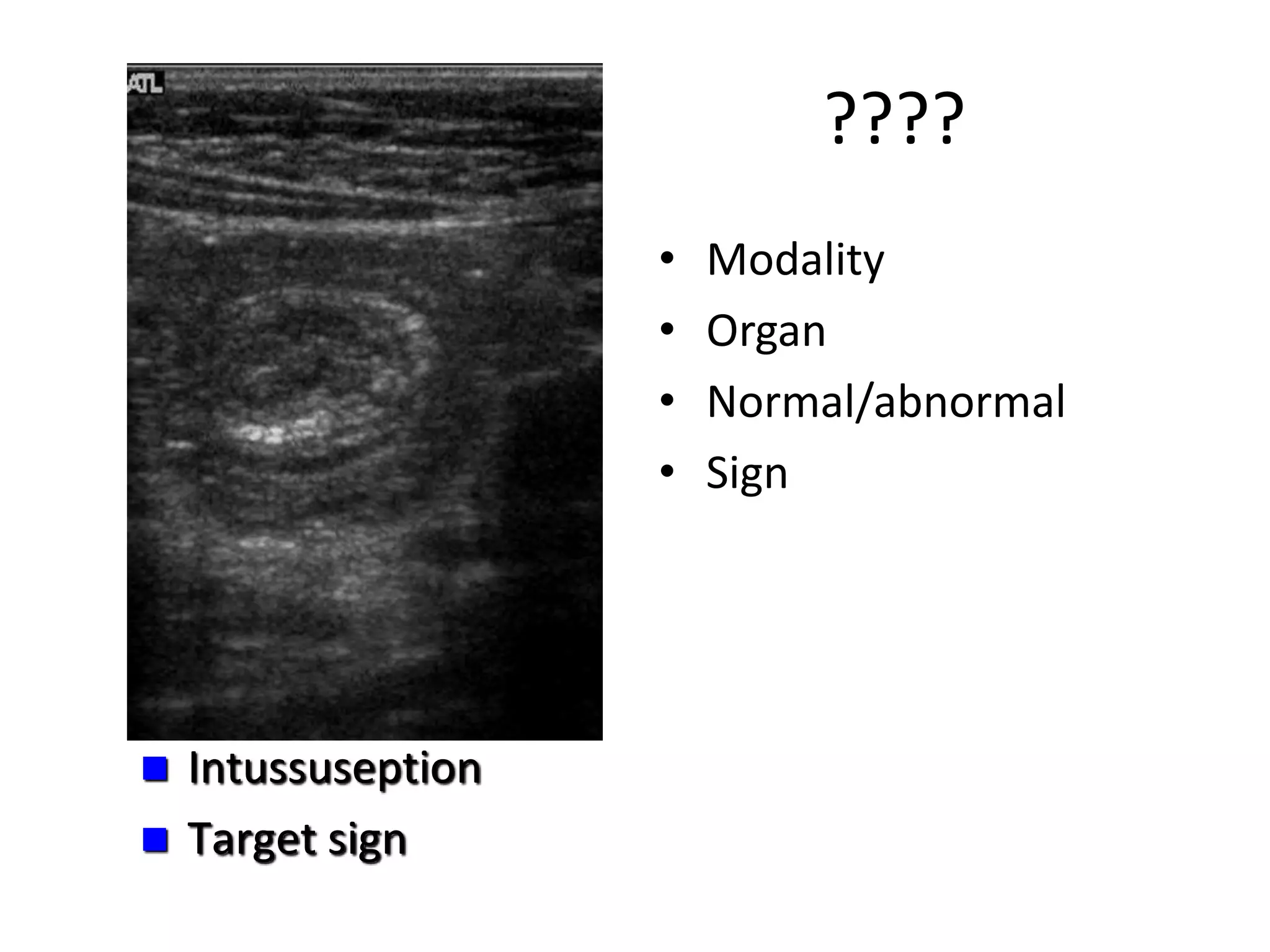 Radiology GIT.ppt