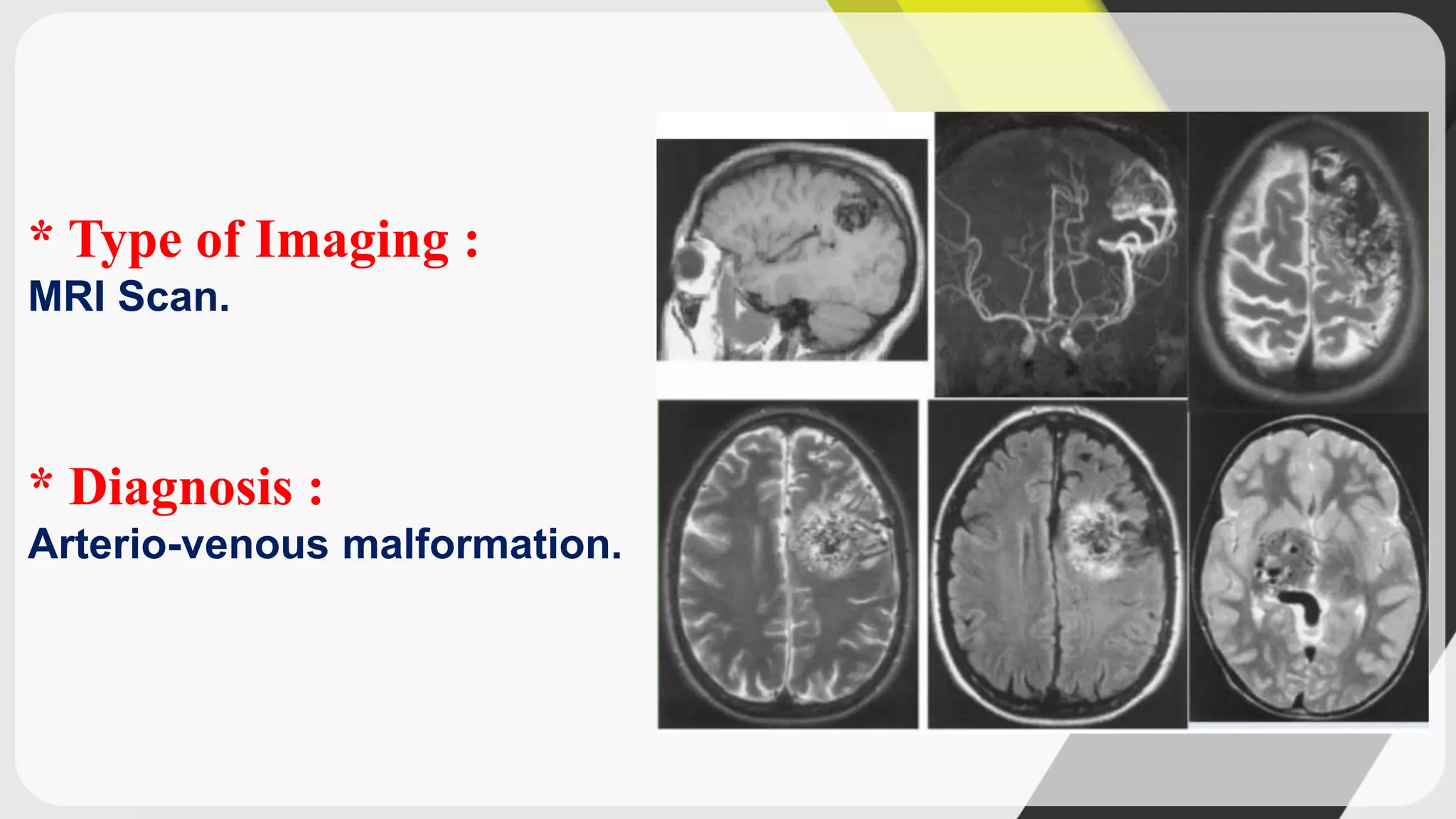 Radiology (imaging of cns disorders) | PDF