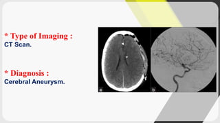 Radiology (imaging of cns disorders) | PDF
