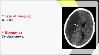 Radiology (imaging of cns disorders) | PDF