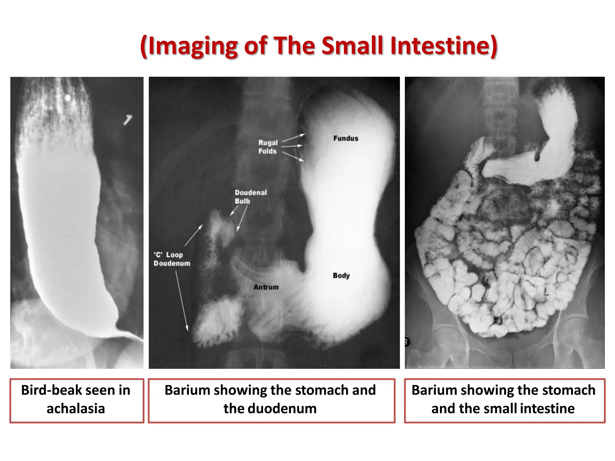 RADIOLOGY/Imaging of The Small Intestine | PPT | Free Download