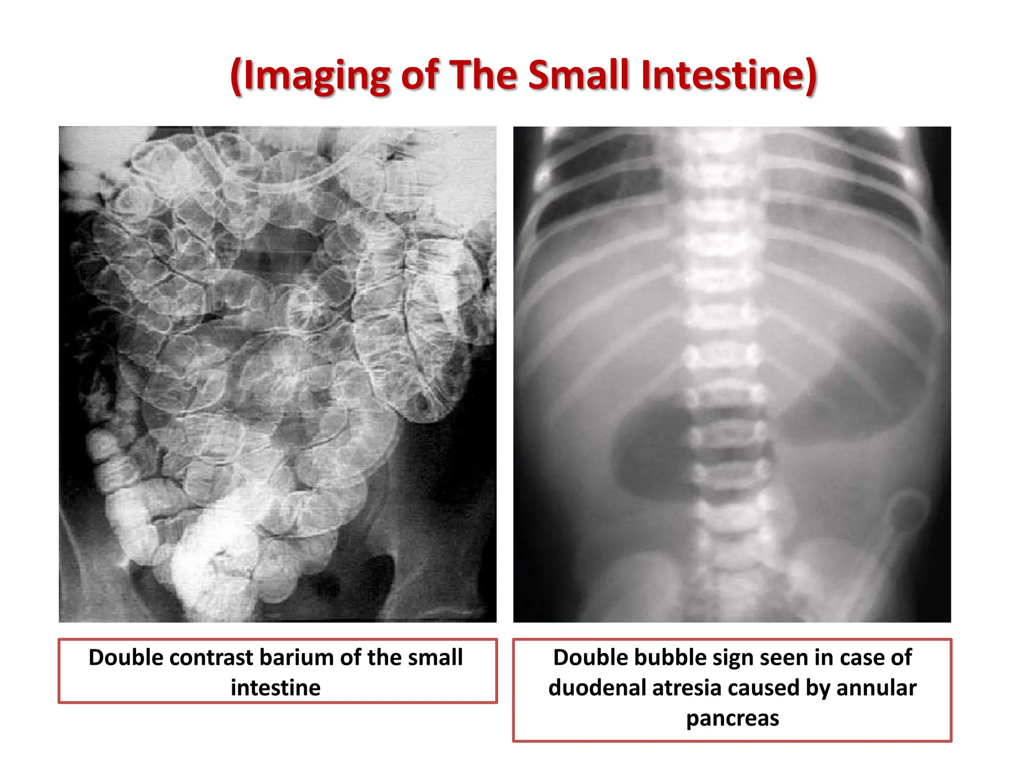 RADIOLOGY/Imaging of The Small Intestine | PPT