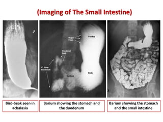 RADIOLOGY/Imaging of The Small Intestine | PPT | Free Download