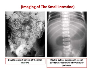 RADIOLOGY/Imaging of The Small Intestine | PPT