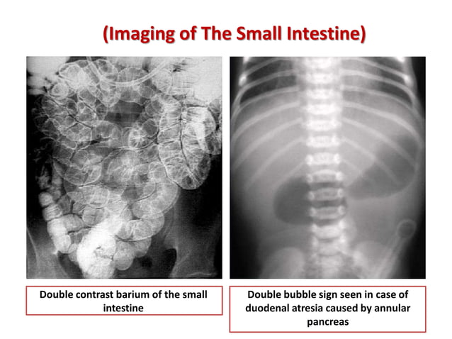 RADIOLOGY/Imaging of The Small Intestine | PPT | Free Download