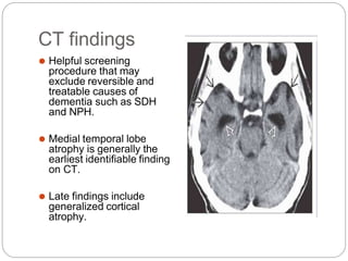 radiology in dementia powerpoint presentation | PPTX