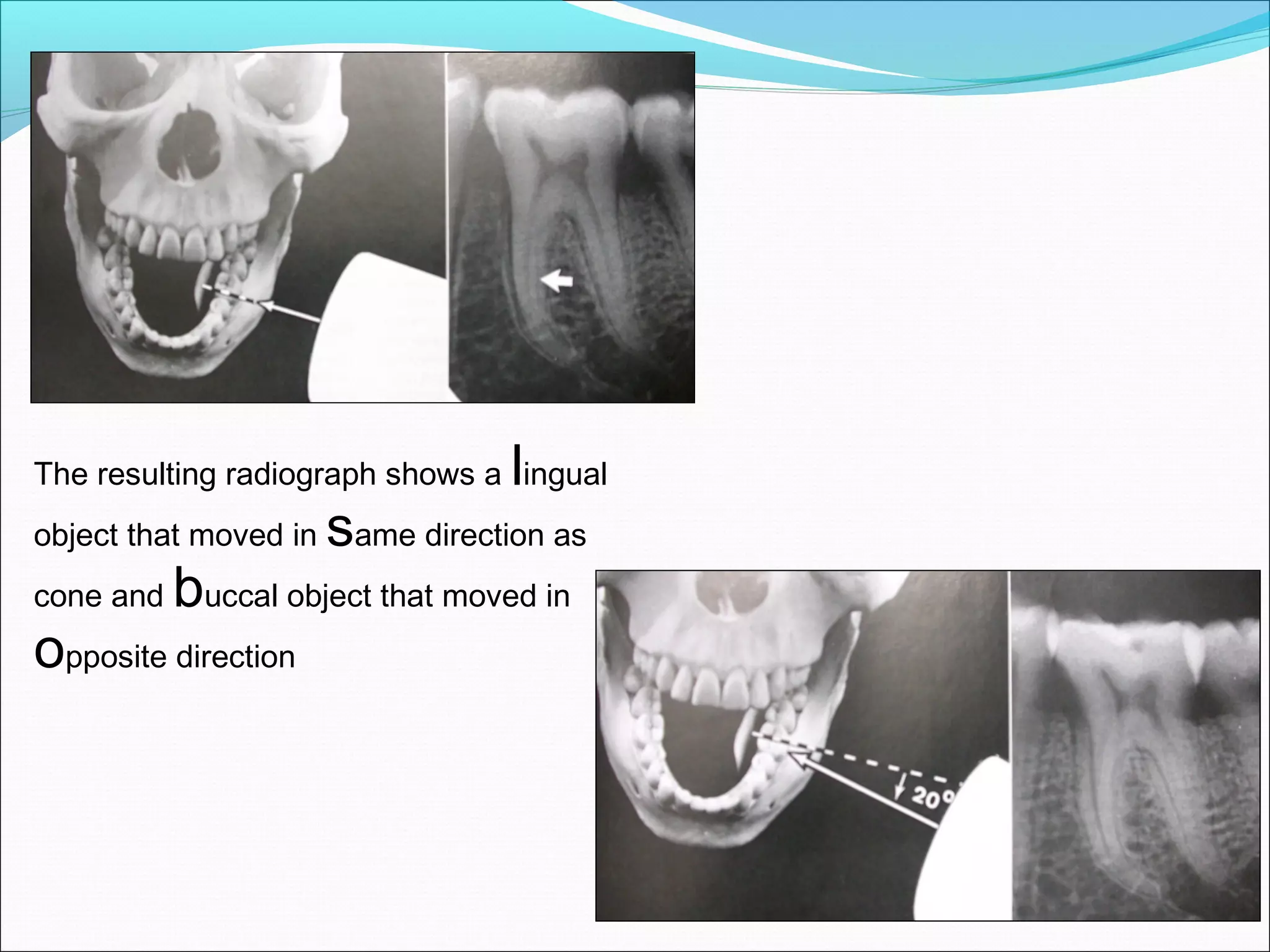 Radiology in dentistry | PPT