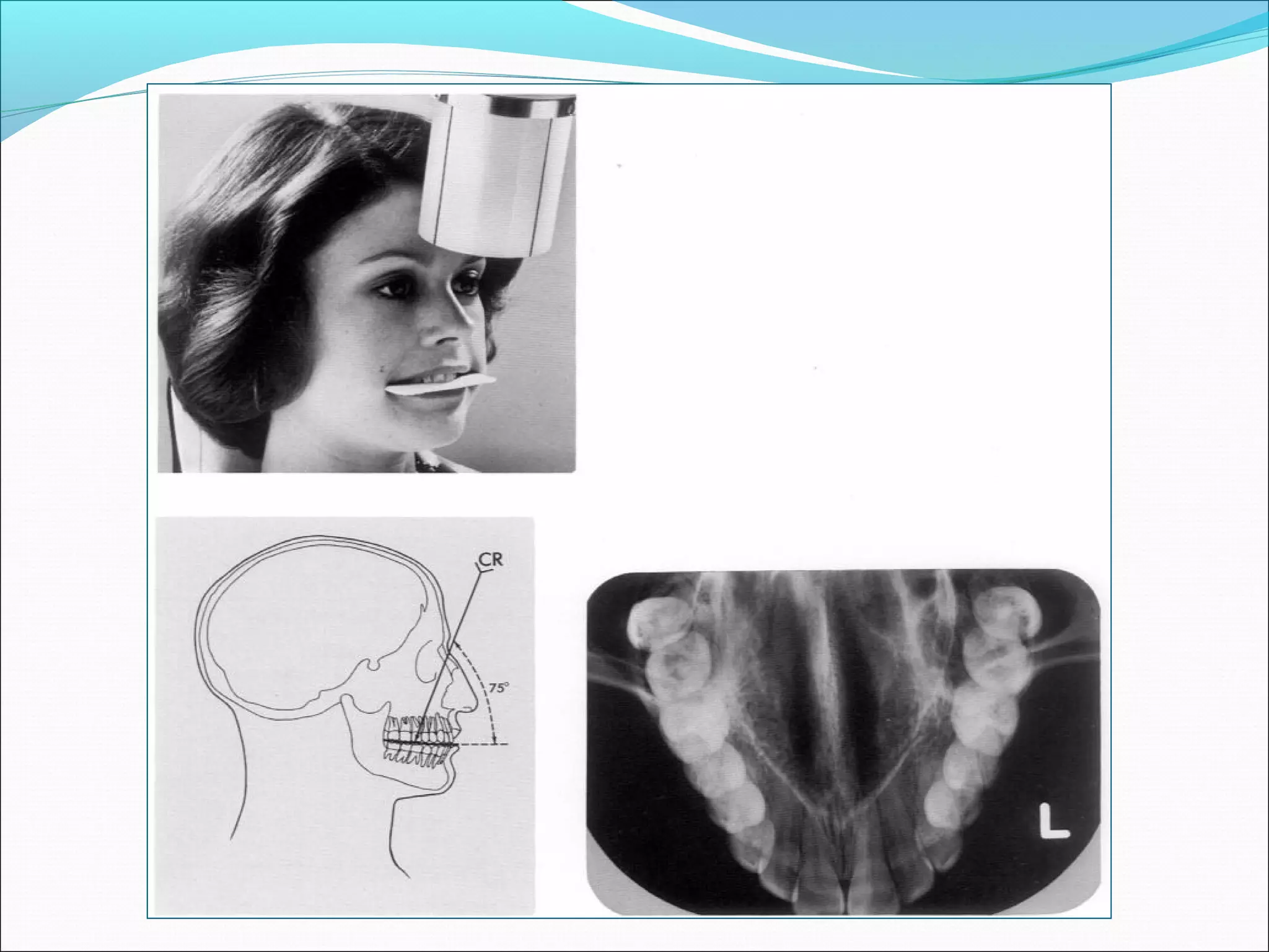 Radiology in dentistry | PPT