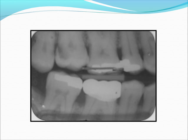 Radiology in dentistry | PPT