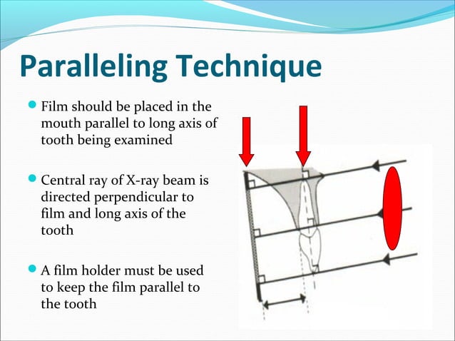 Radiology in dentistry | PPT