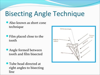 Radiology in dentistry | PPT