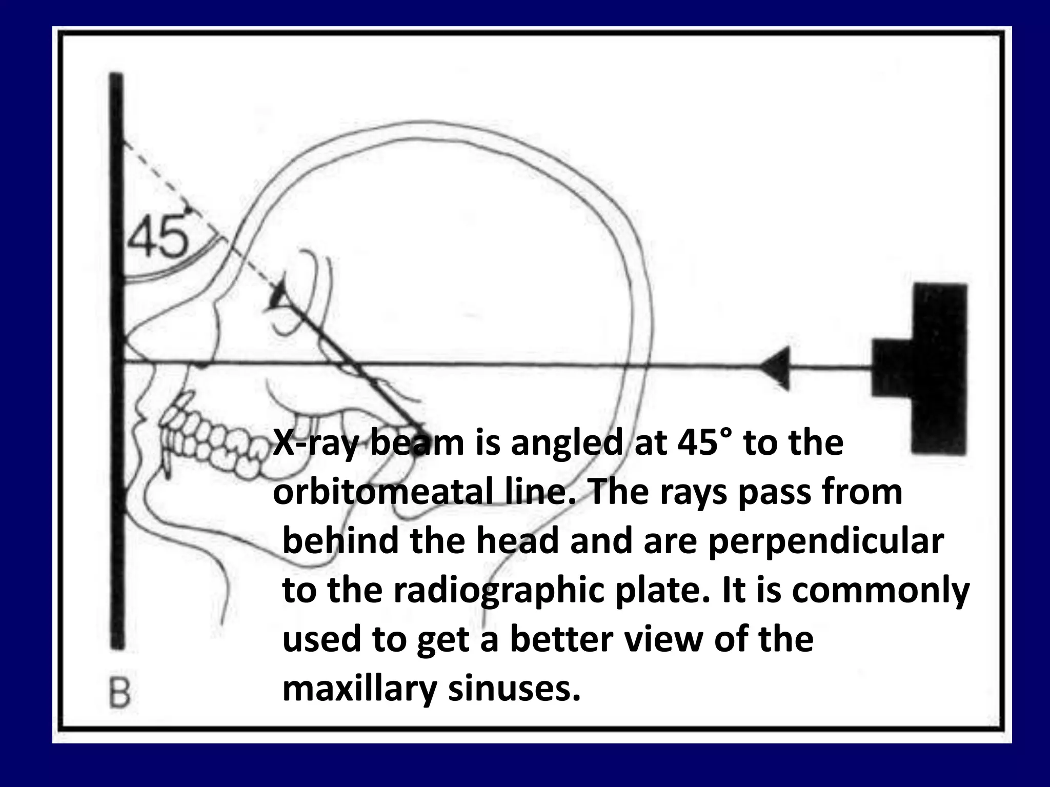 Radiology in ENT | PPTX