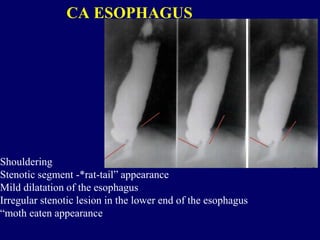 Radiology in ENT | PPT