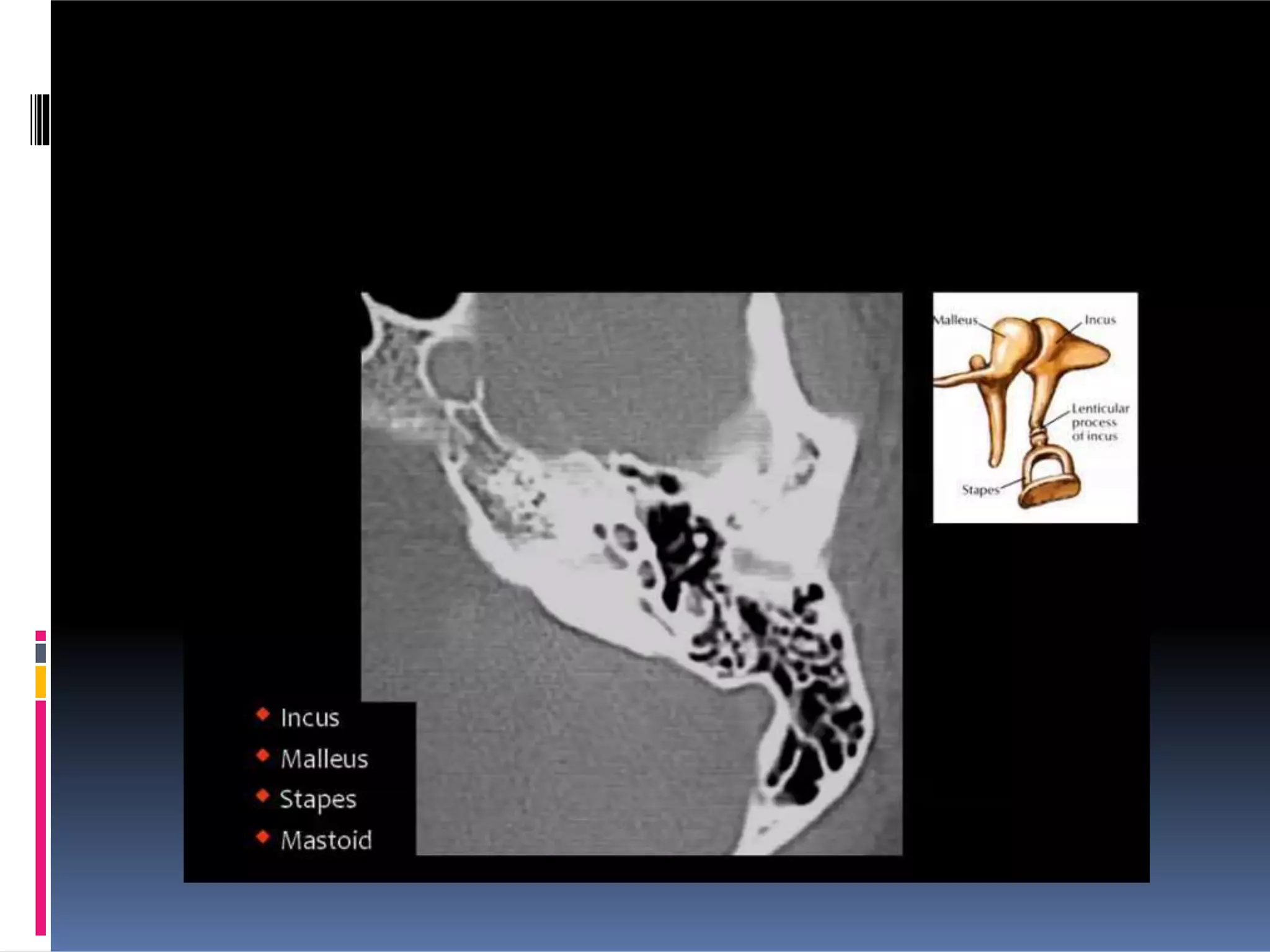 Radiology in ENT | PPTX