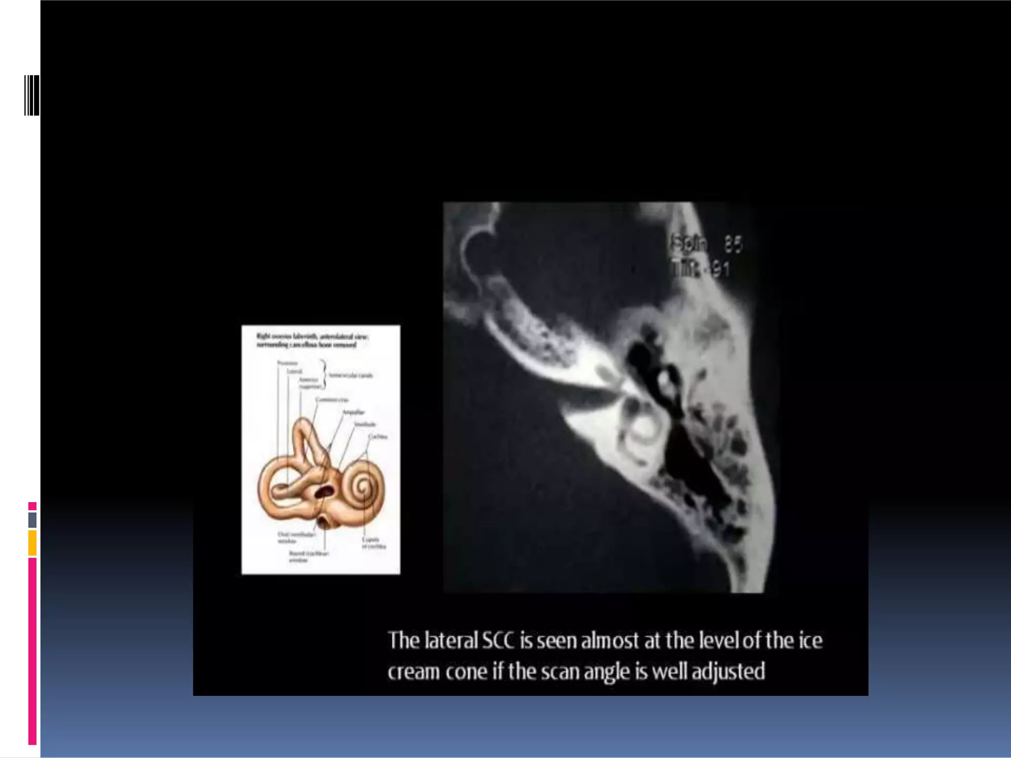Radiology in ENT | PPTX