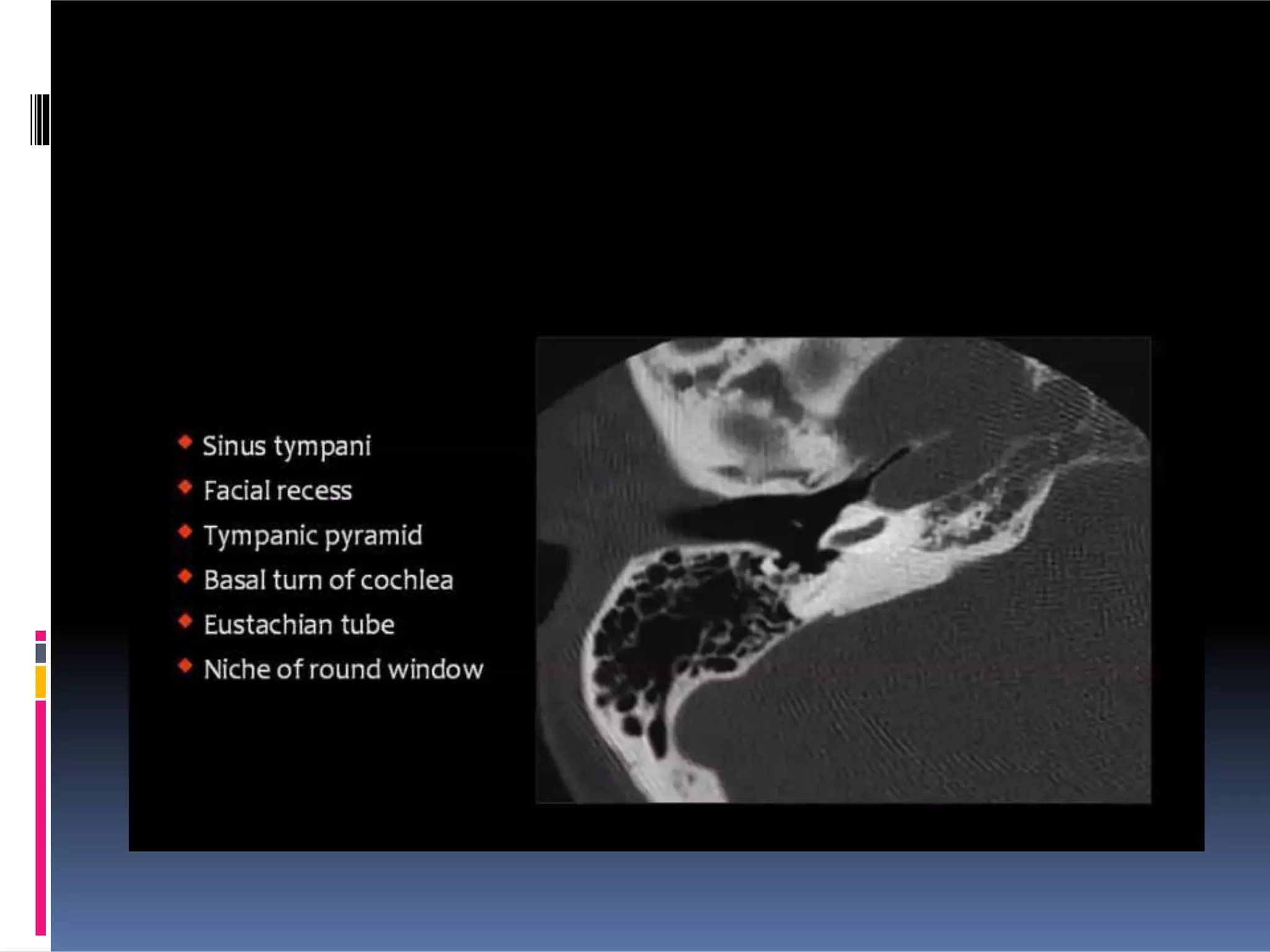 Radiology in ENT | PPTX