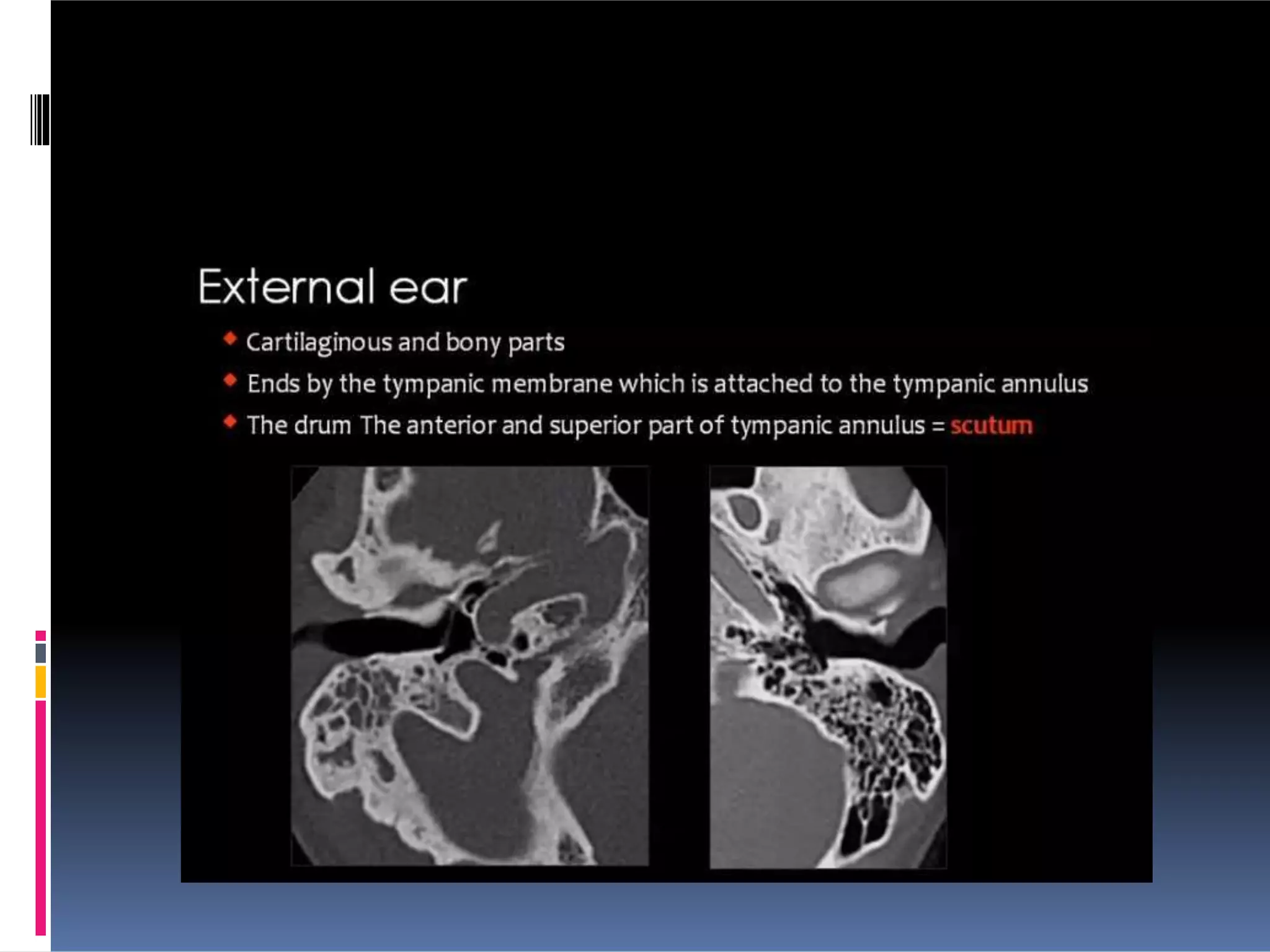 Radiology In Ent Pptx