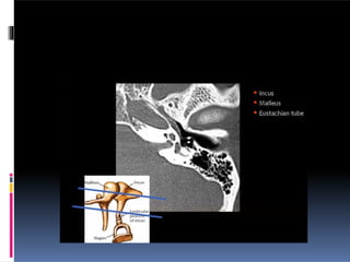Radiology in ENT | PPTX
