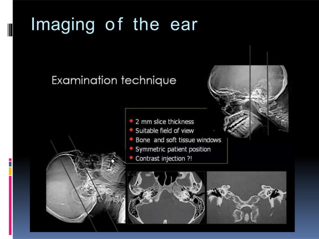 Radiology in ENT | PPTX | Ear, Nose and Throat Conditions | Diseases ...