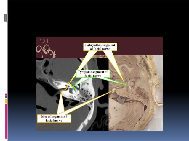 Radiology in ENT | PPTX | Ear, Nose and Throat Conditions | Diseases ...
