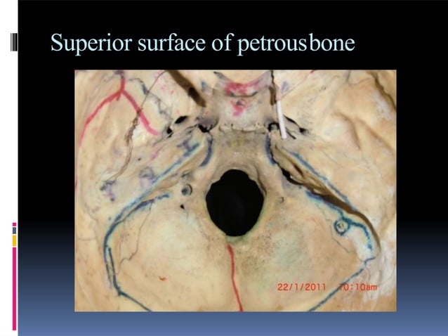 Radiology in ENT | PPTX | Ear, Nose and Throat Conditions | Diseases ...