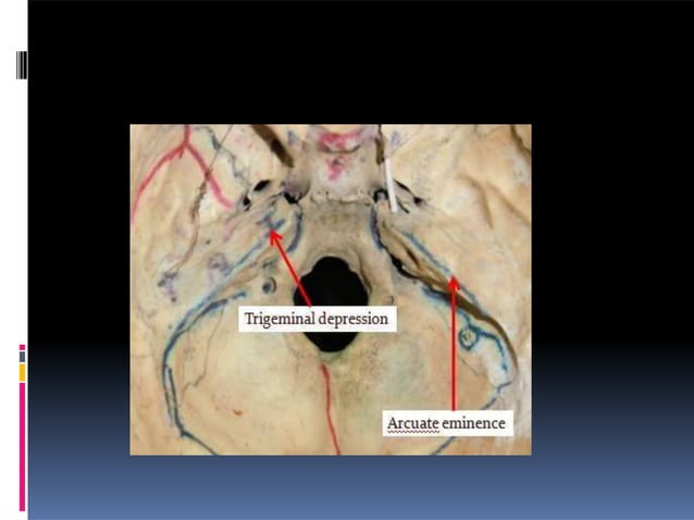 Radiology in ENT | PPTX | Ear, Nose and Throat Conditions | Diseases ...