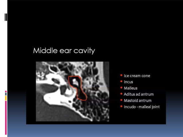 Radiology in ENT | PPTX | Ear, Nose and Throat Conditions | Diseases ...